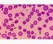 Fichero de Hematologia